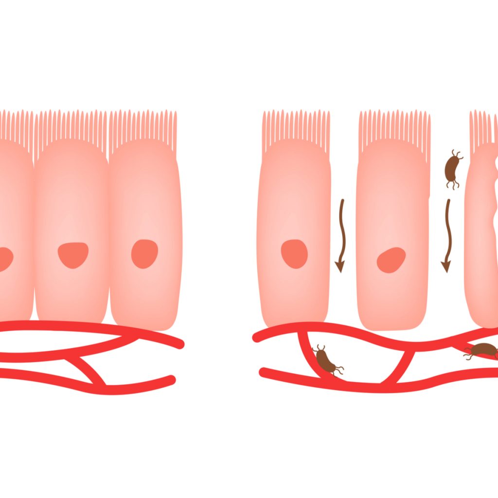 ZONULINA en Heces - Estudios Analíticos aplicados a la clínica